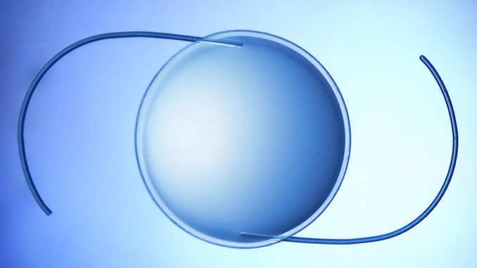 Rxsight’s Light Adjustable Lens Got FDA Approval – Scipreneur